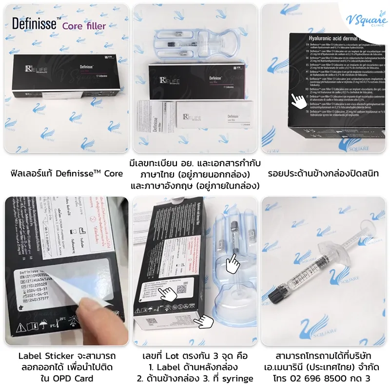 Definisse Filler ฟิลเลอร์อิตาลี จุดเด่น ตำแหน่งฉีด และราคา